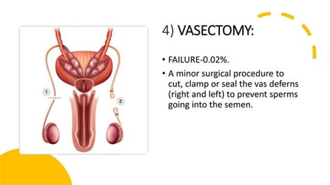 Male Contraception Powerpoint Presentation Ppt
