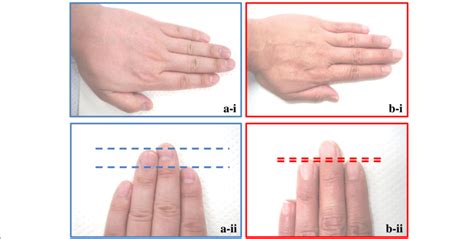 Relationship Between The Difference In Ring And Index Finger Lengths