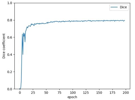 UNet训练 UNet 极客文档