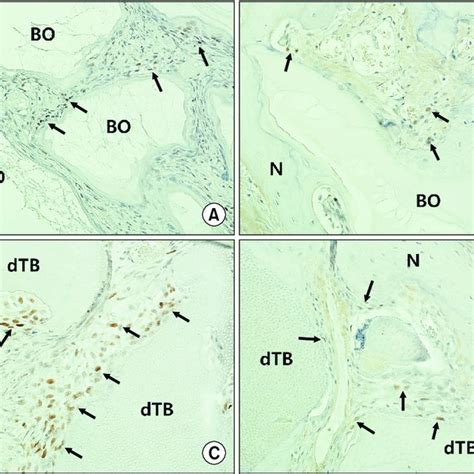 Immunohistochemical Staining ×200 With Proliferating Cell Nuclear