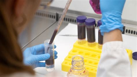Translational Research Services In Immuno Oncology I Cro