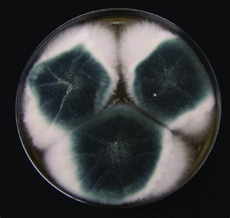 Aspergillus Fumigatus Growth On Sabouraud Dextrose Agar Plate