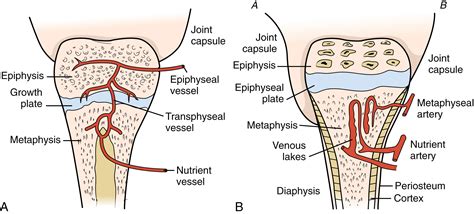Osteomyelitis Clinical Tree