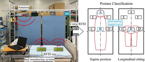 Posture Classification With A Bed Monitoring System Using Radio Frequency Identification