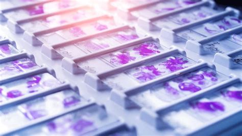 Optimize Ffpe Library Prep For Enhanced Ngs Performance Technology