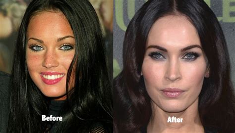 Extraordinary And Extreme Plastic Surgery Before And After Photo Session