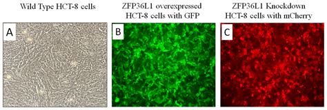 Zfp36 Ring Finger Protein Like 1 Significantly Suppresses Human