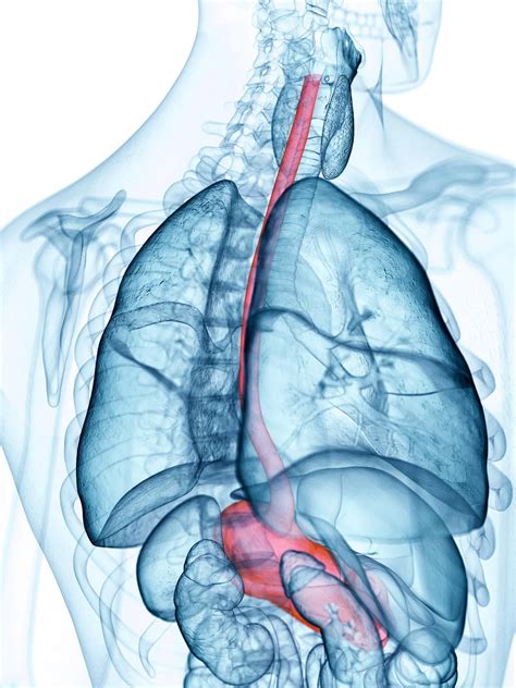 Enfermedades Del Esófago Causas Síntomas Y Tratamiento Doctor Online