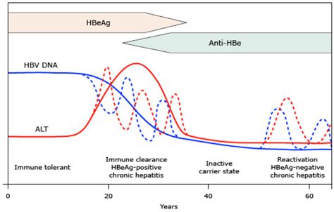 Chronic Hepatitis B Confused No More Brown Med Peds