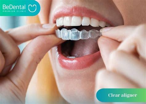 Invisalign Clear Aligner Orthodontic Treatment Be Dental