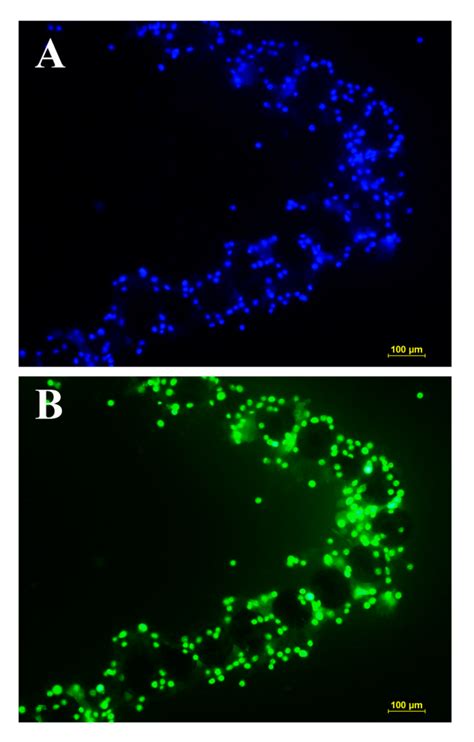 Clinical Microfluidic Chip Platform For The Isolation Of Versatile Circulating Tumor Cells