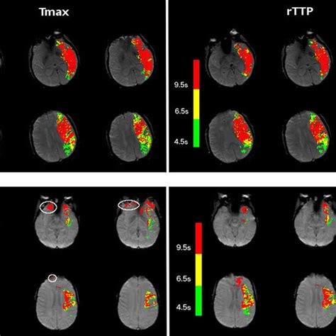 Overview Of Patients Whose Pwidwi Mismatch Classification Differs
