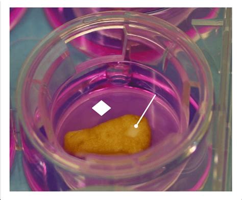 Human Skin Specimen Processing The Skin Samples Were Cultured In Download Scientific Diagram