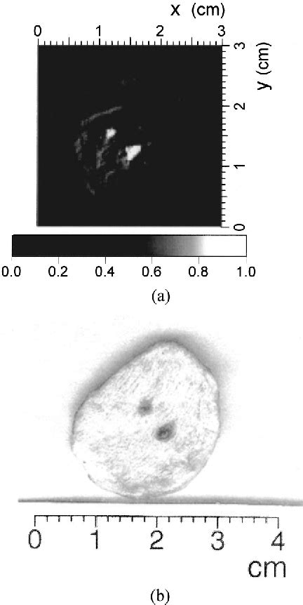 Figure 4 From Photoacoustic Tomography Of Biological Tissues With High