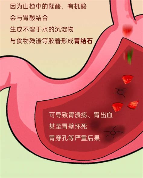 水果居然会伤胃，多吃一口胃痛翻倍！ 知乎