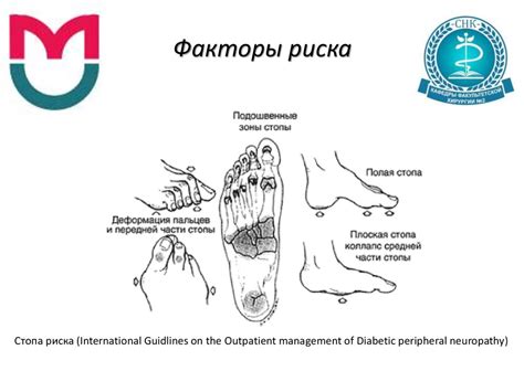 Синдром диабетической стопы в клинической практике, алгоритм ...