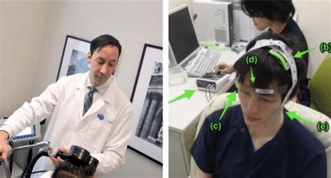 Knowing The Difference Between RTMS And TDCS Mid City TMS