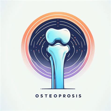 World Osteoporosis Day Osteoporosis Vector Illustration Orthopedics