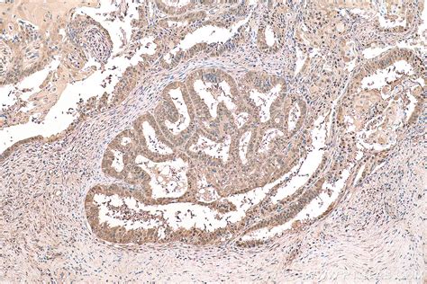 Ihceasy Gss Ready To Use Ihc Kit Khc0781 Proteintech 武汉三鹰生物技术有限公司