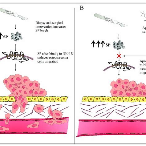 A Surgical Procedures Biopsy Or Surgical Intervention Can Induce Download Scientific