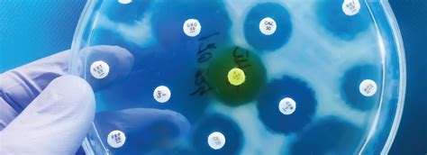 Superbugs And Antimicrobial Resistance A Global Health Crisis Norgen