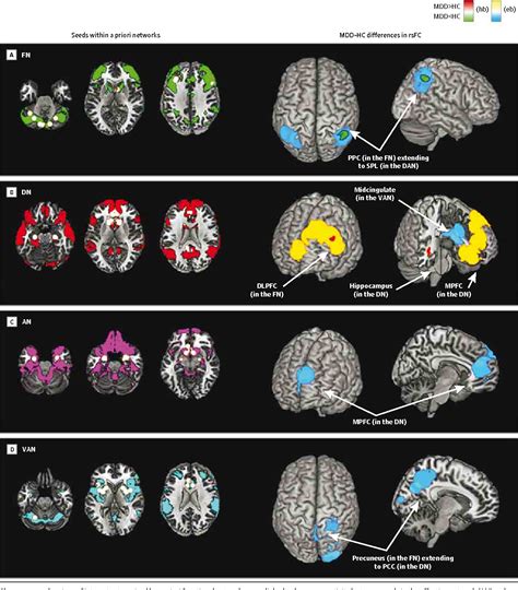 Figure 1 From Large Scale Network Dysfunction In Major Depressive Disorder A Meta Analysis Of