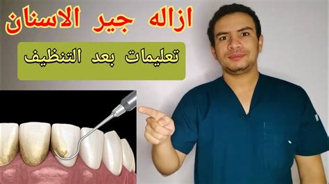 جير الاسنان كارثه تهدد اسنانك ازاله جير الاسنان اعراض جير الاسنان