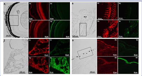 Immunohistochemical Localization Of Inositol Monophosphatase 1 Impa1