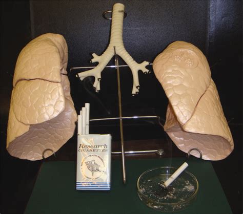 After Second Hand Smoke Lungs