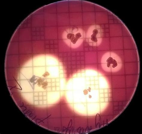 Zone Of Inulin Hydrolysis Download Scientific Diagram