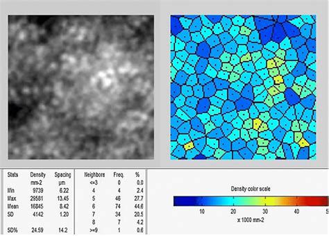 Voronoi Tessellation Of The Photoreceptors Cones In A 100 μ × 100 μ Download Scientific