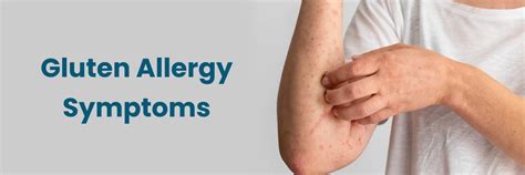Common Symptoms Of Gluten Allergy Celiac Disease And Ncgs