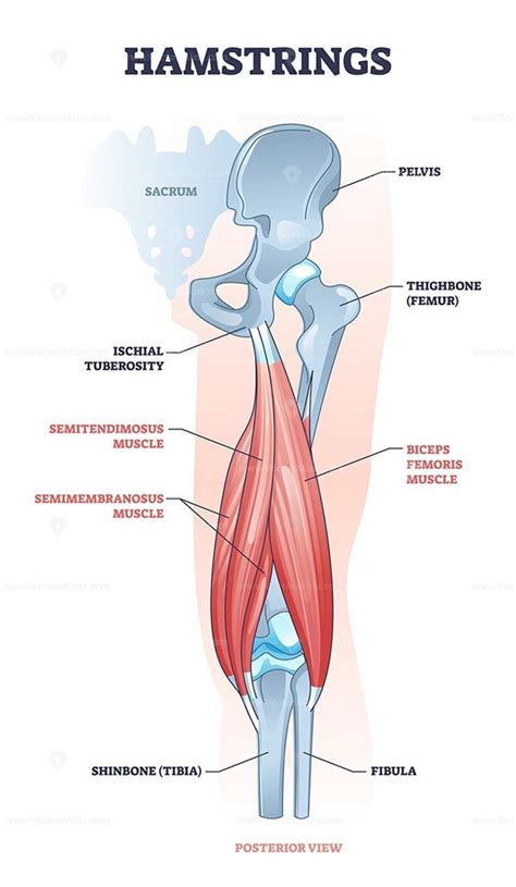 Ischial Tuberosity Muscles How To Treat Proximal Hamstring