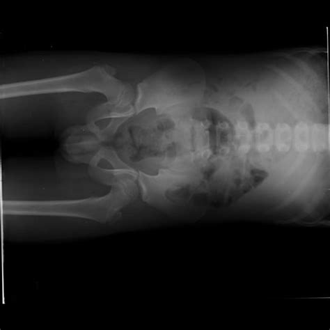 Yolofracturedetection Object Detection Dataset By Cvpr