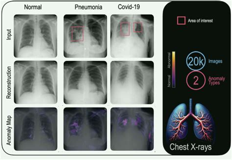 Towards Universal Unsupervised Anomaly Detection In Medical Imaging