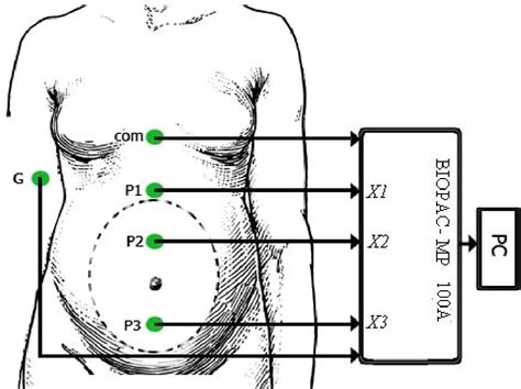 Figure 1 From Evaluation Of An Improved Algorithm For Fetal Qrs
