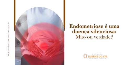 Endometriose é uma doença silenciosa mito ou verdade Clínica Rubens do Val CRM