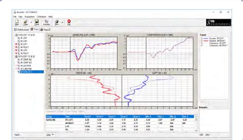 Analysis View Comparing A Baseline Left Right Result With A Follow On