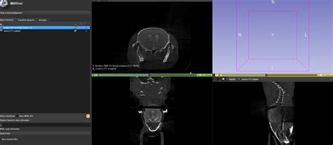 saving overlayed images support 3d slicer community