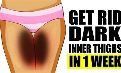 Natural Ways To Get Rid Of Dark Inner Thighs In Just 7 Days Dark Spots On Skin Lighten Inner