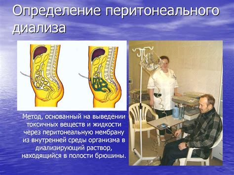 Перитонеальный диализ Online Presentation