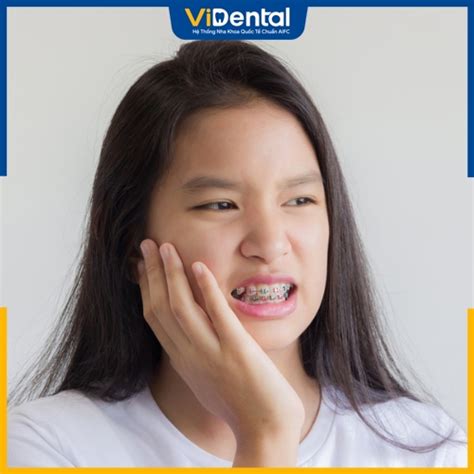 Niềng Răng Có Ảnh Hưởng Đến Thần Kinh Không Các Lưu Ý Cần Biết