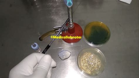 Vibrio Cholerae Serotyping Introduction Principle Test Requireme