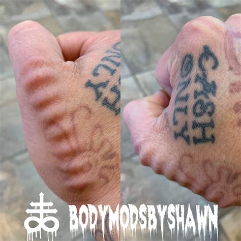 Silicone Implants Body Modification