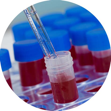 Polymorphprep Density Gradient Media