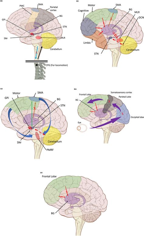 H1 Abnormal Control Outputs From Central Pattern Generators The Download Scientific