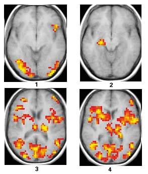 Functional MRI For Personal Use Beating The Search Engine