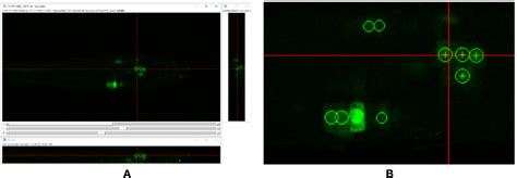 Figure 8 From Volumetric Segmentation Of Cell Cycle Markers In Confocal Images Using Machine