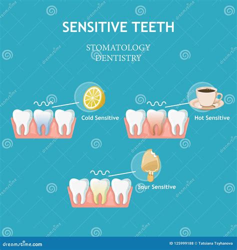 Sensitive Teeth Stomatology Dentistry Vector Concept Stock Vector