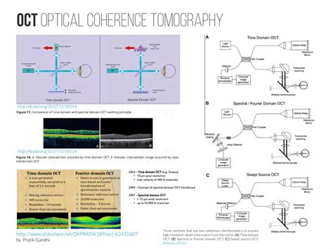 Shallow Introduction For Deep Learning Retinal Image Analysis Pdf